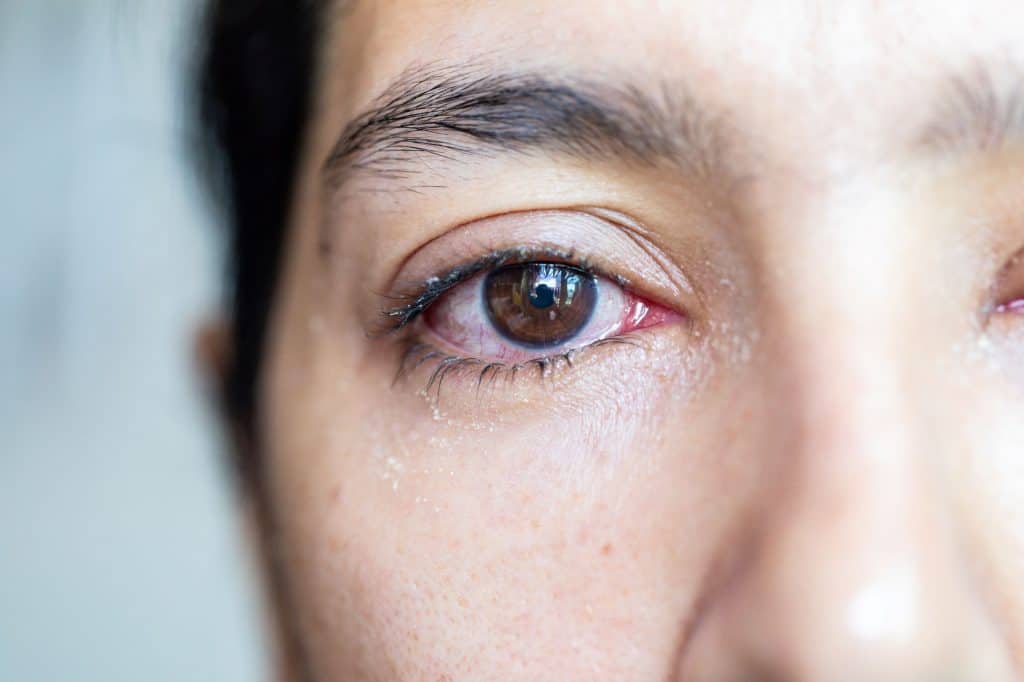 10 Things Your Eyes Say About Your Overall Health - Healthcare Business ...